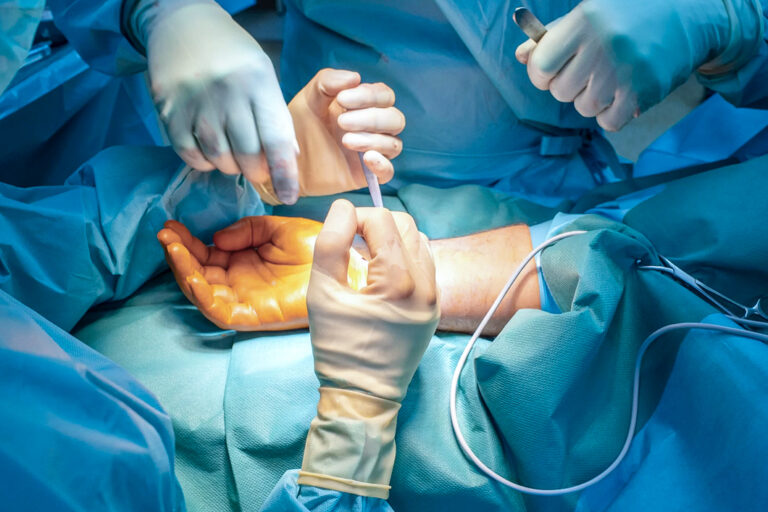 Hand and Microvascular Surgery At Cutis International | No1 Clinic